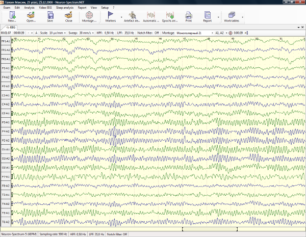 Neuron-Spectrum-4/P - 21-channel Clinical Diagnostic EEG System Neurosoft