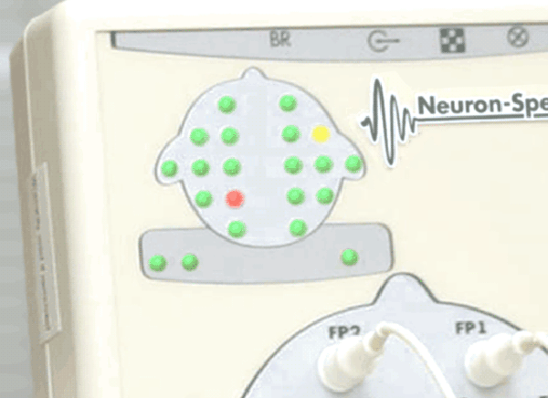 Neuron-Spectrum-4/P - 21-channel Clinical Diagnostic EEG System Neurosoft