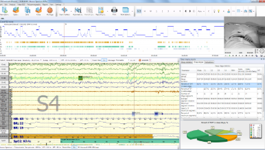 Neuron-Spectrum-65/PSG Neurosoft
