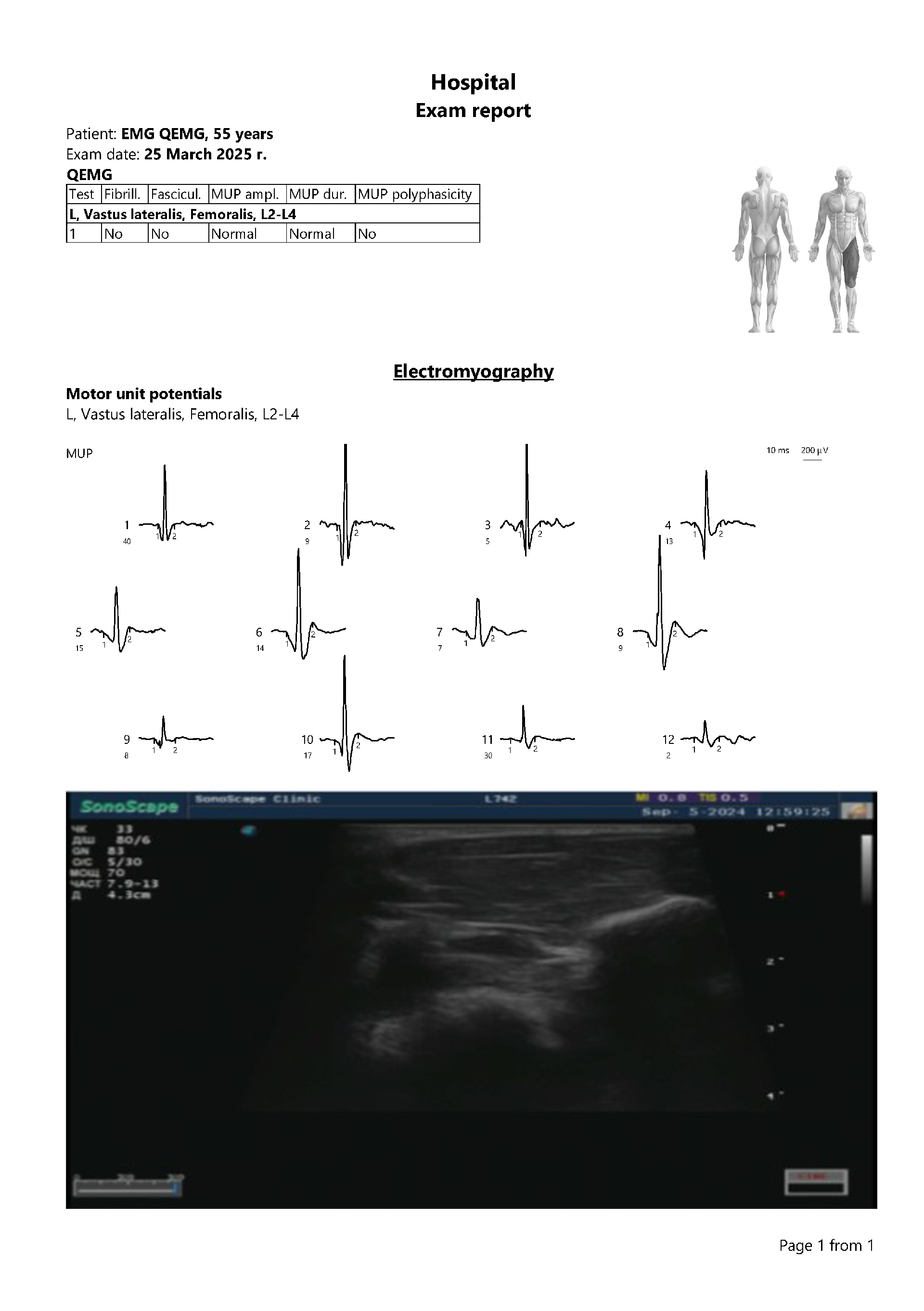 COMBINED USE OF ULTRASOUND AND EMG Neurosoft