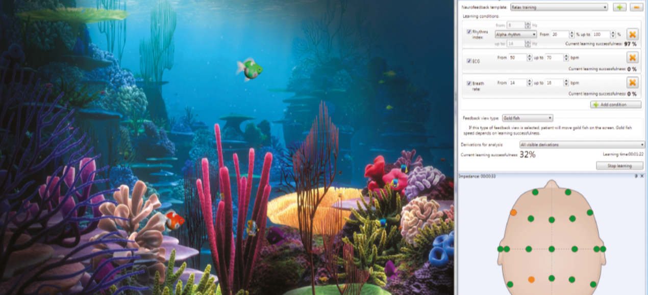 Software and equipment "Neuron-Spectrum-BFB" Neurosoft