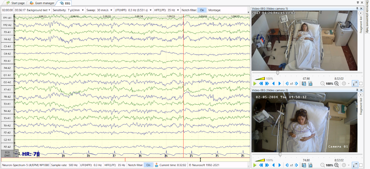 Software and equipment "Neuron-Spectrum-Video" Neurosoft